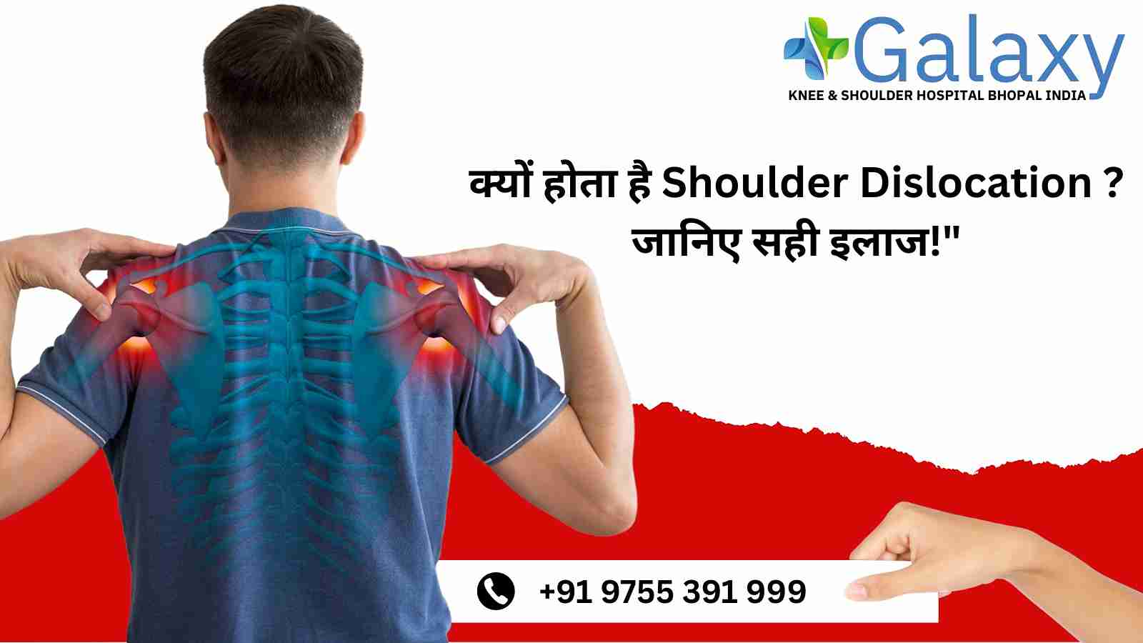 Best Shoulder Dislocation Surgery in Bhopal ☎ +91-9755391999
